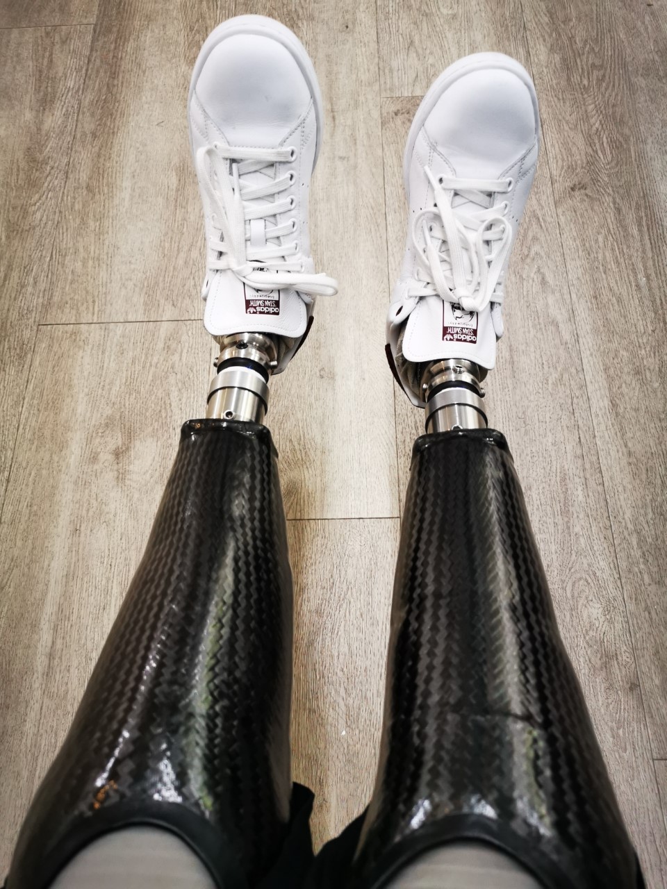 Leben mit Beinamputation und Beinprothese – Perspektivenwechsel mit ...